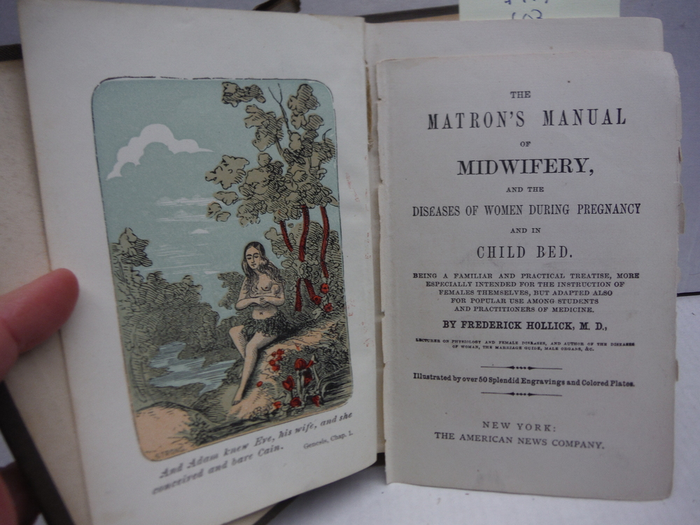 The matron's manual of midwifery,: And the diseases of women during ...