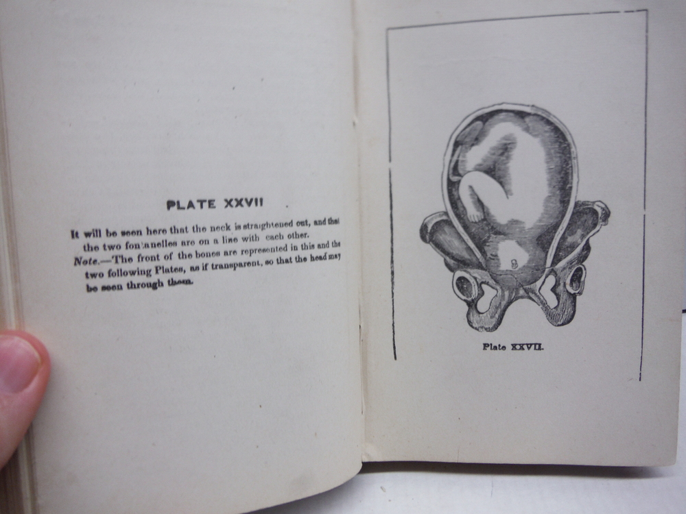 The matron's manual of midwifery,: And the diseases of women during ...